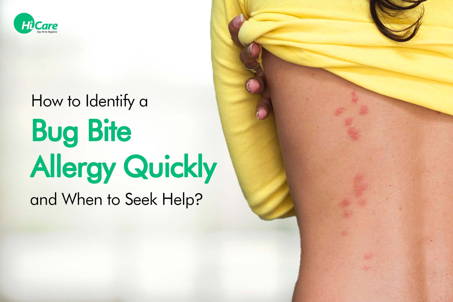 10 Symptoms of Bug Bite Allergy and How To Treat Them Quickly – HiCare ...